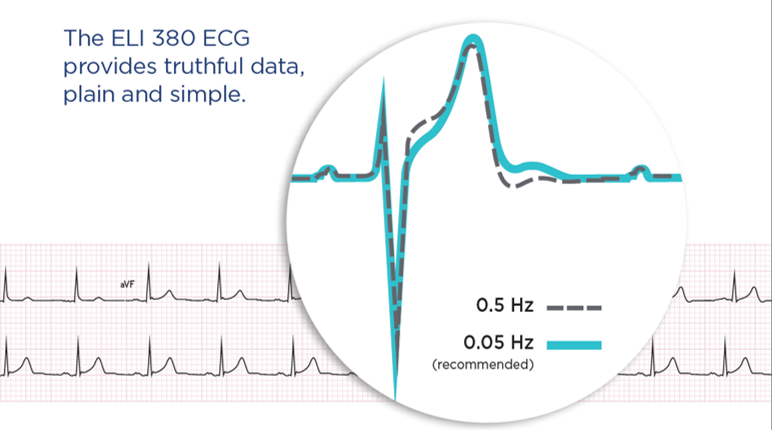 Electrocardiógrafo de Diagnostico de 12 derivaciones Mortara modelo ELI ...